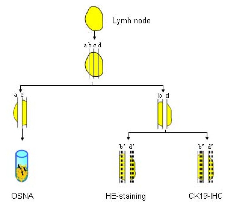 One Step Nucleic Acid Amplification (OSNA) - a new method for lymph ...