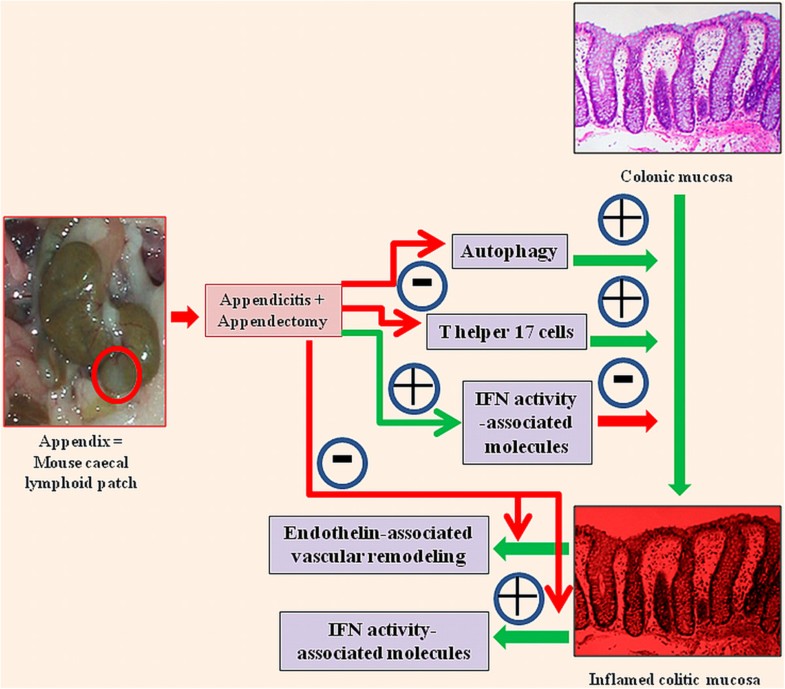 A novel model of appendicitis and appendectomy to investigate ...