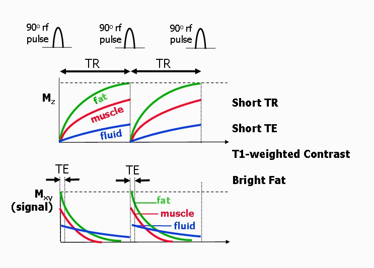 Cardiovascular magnetic resonance physics for clinicians: part I ...
