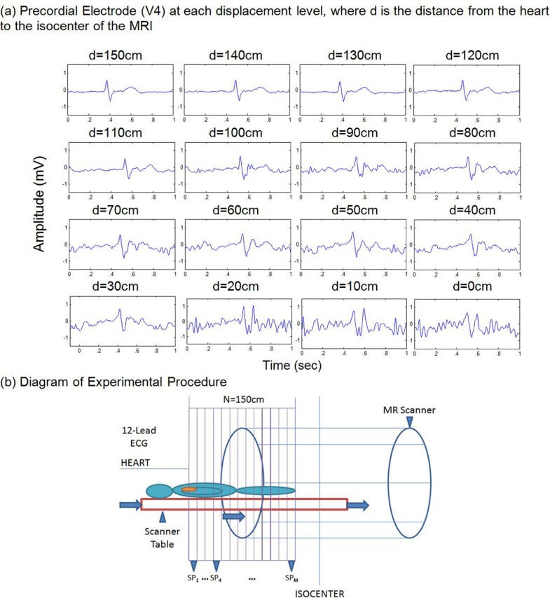 Peripheral perfusion index measured using magnetohydrodynamic voltages ...