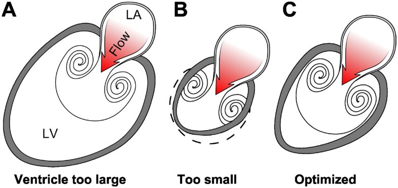 The shape of the healthy heart is optimized for vortex ring formation ...