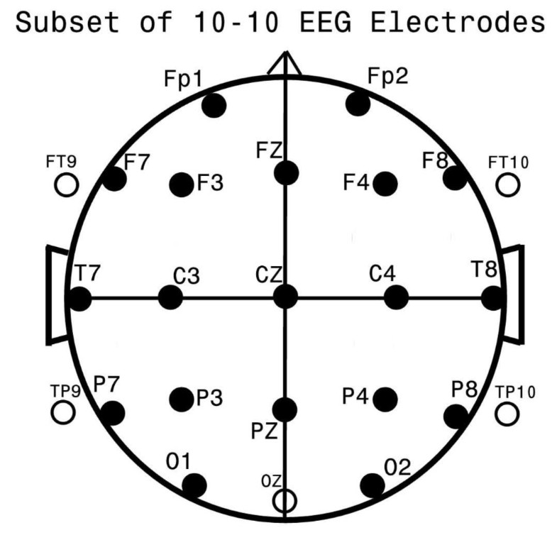 A stable pattern of EEG spectral coherence distinguishes children with ...