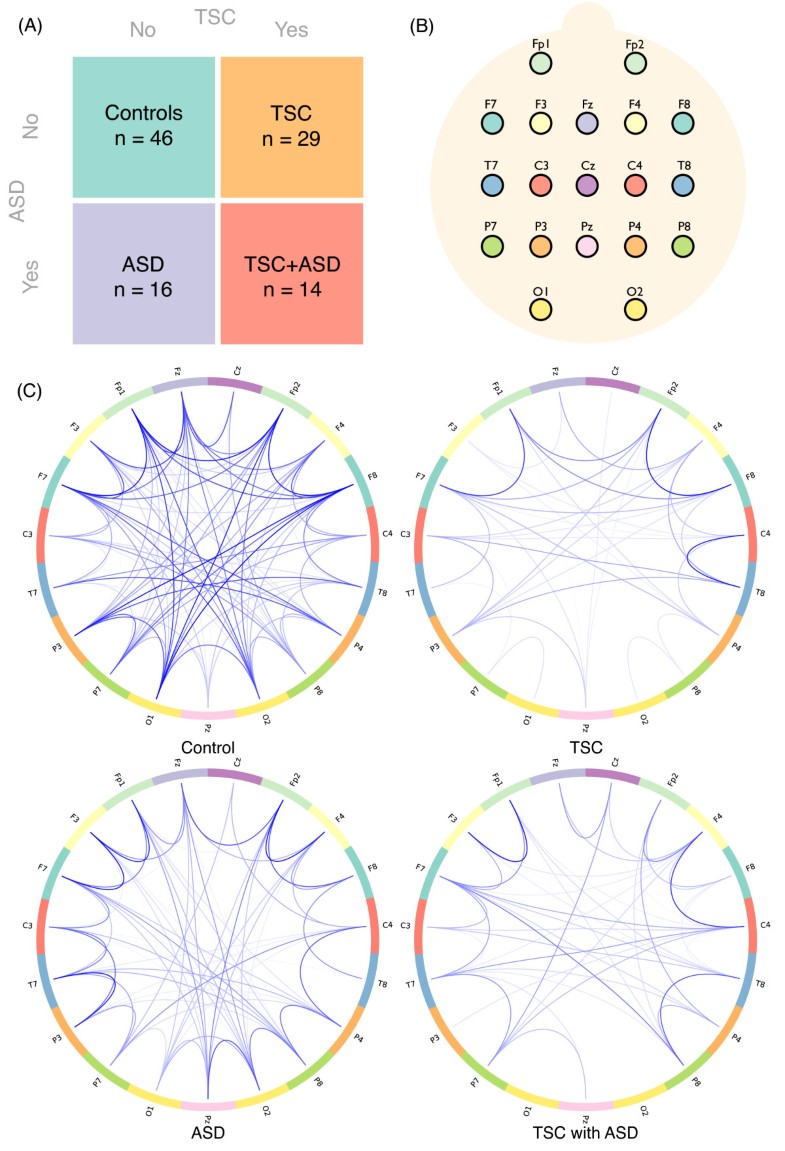 Brain functional networks in syndromic and non-syndromic autism: a ...