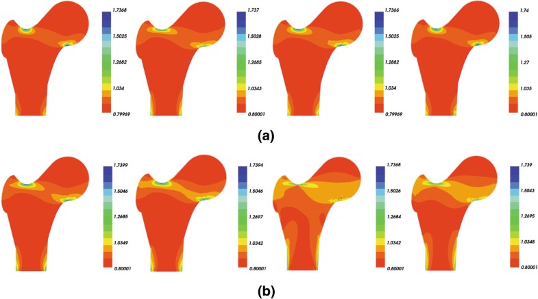 Computational simulation of the bone remodeling using the finite element method: an elastic ...