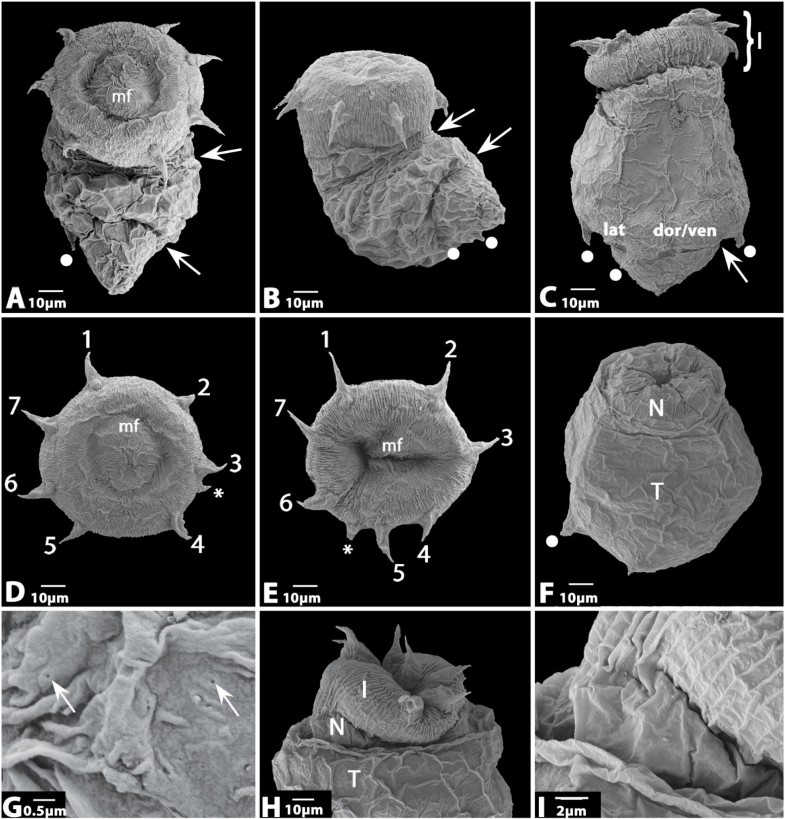 The hatching larva of the priapulid worm Halicryptus spinulosus ...