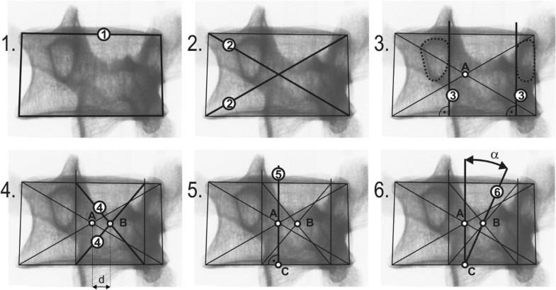 The radiographic method for evaluation of axial vertebral rotation ...