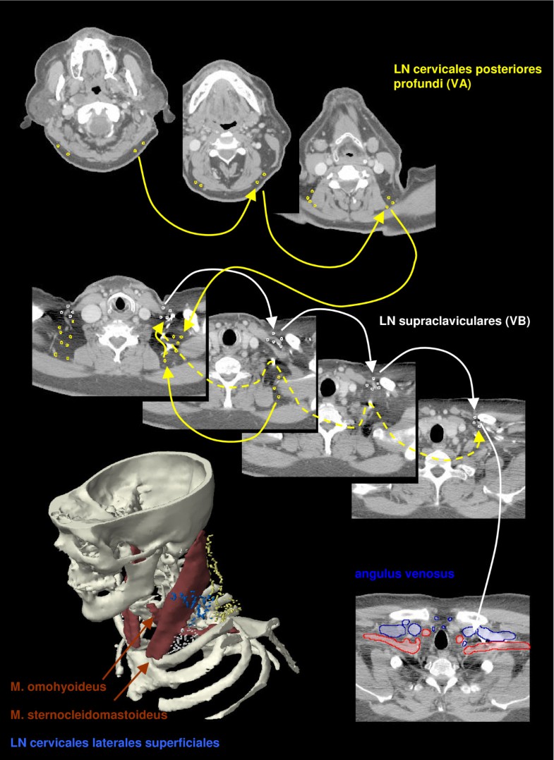 Guidelines For Delineation Of Lymphatic Clinical Target Volumes For