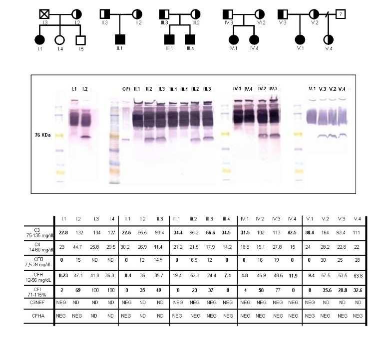 Complement factor I deficiency: a not so rare immune defect ...