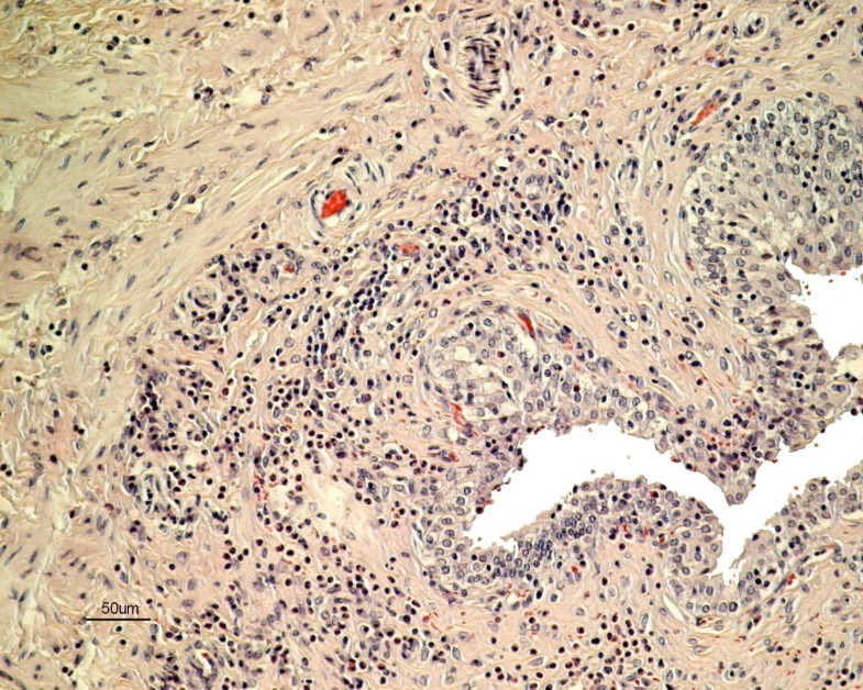 Pearsonema (syn Capillaria) plica associated cystitis in a ...