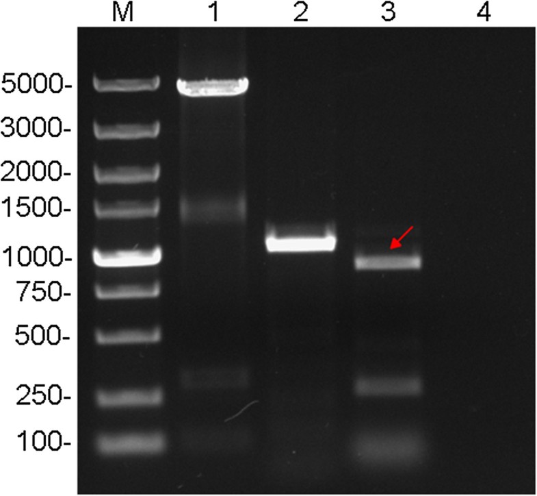 Rapid establishment of a HEK 293 cell line expressing FVIII-BDD using ...