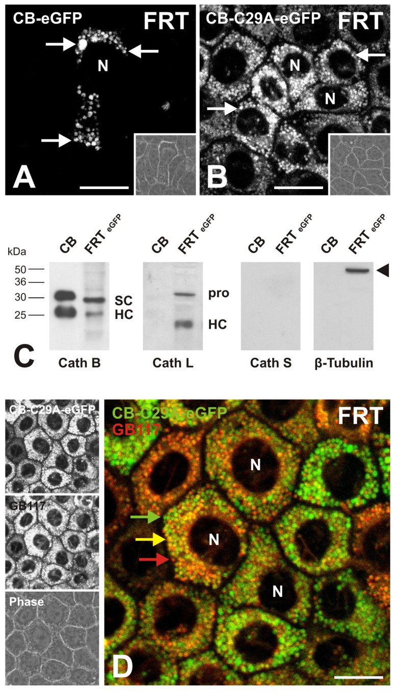 Cathepsin B trafficking in thyroid carcinoma cells | Thyroid Research ...