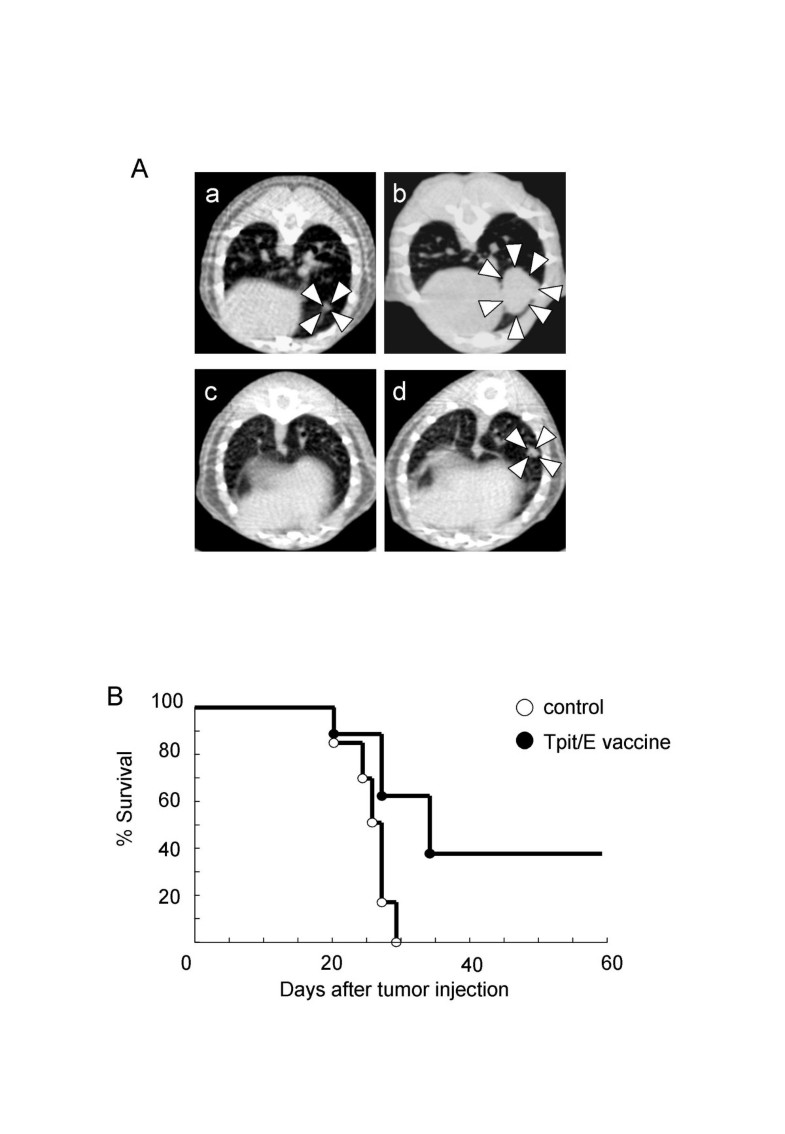 Inhibition of B16 melanoma growth and metastasis in C57BL mice by ...