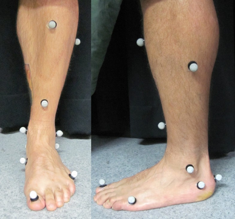 Relationships between foot type and dynamic rearfoot frontal plane ...