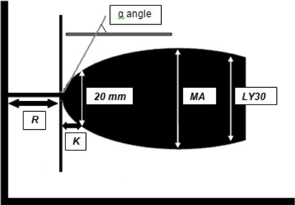 Thrombelastography (TEG®): practical considerations on its clinical use ...
