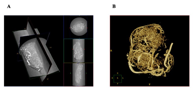 Micro computed tomography for vascular exploration | Vascular Cell ...