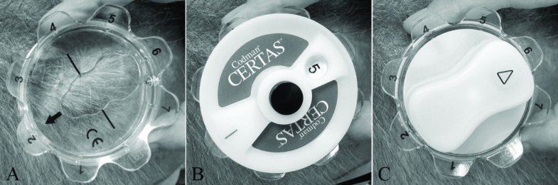 Initial experience with the Codman Certas adjustable valve in the ...