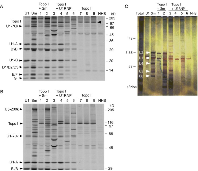 Frequent coexistence of anti-topoisomerase I and anti-U1RNP ...