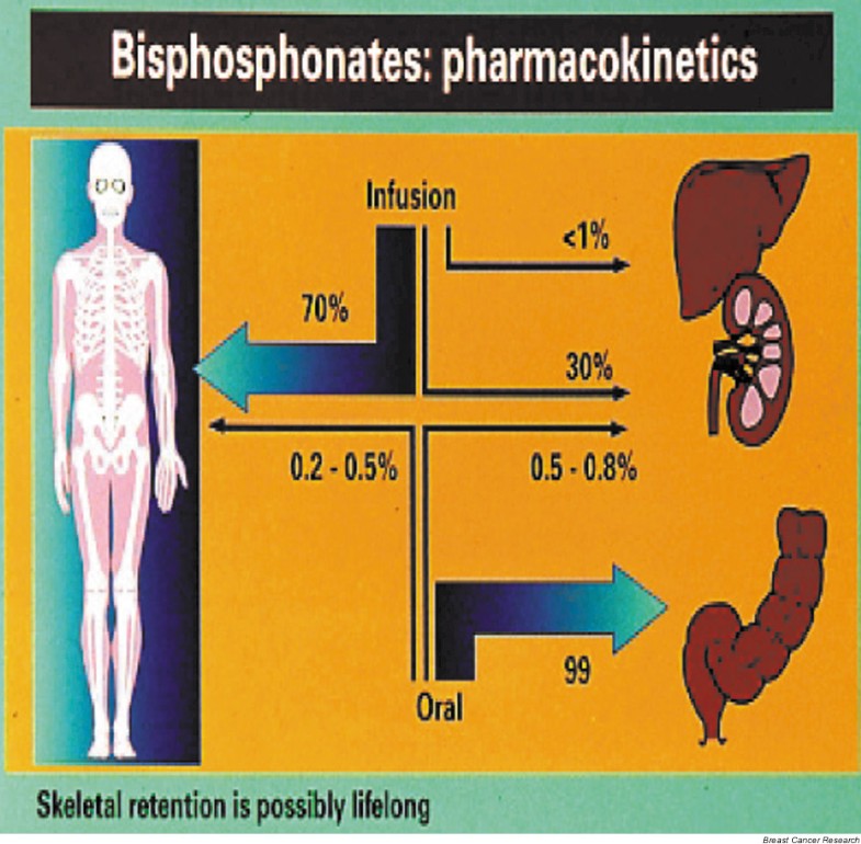 The Role Of Bisphosphonates In Breast Cancer The Present And Future