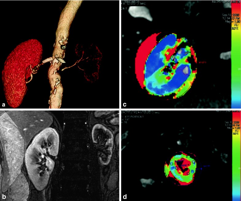 Measurement of kidney perfusion in critically ill Patients | Critical ...