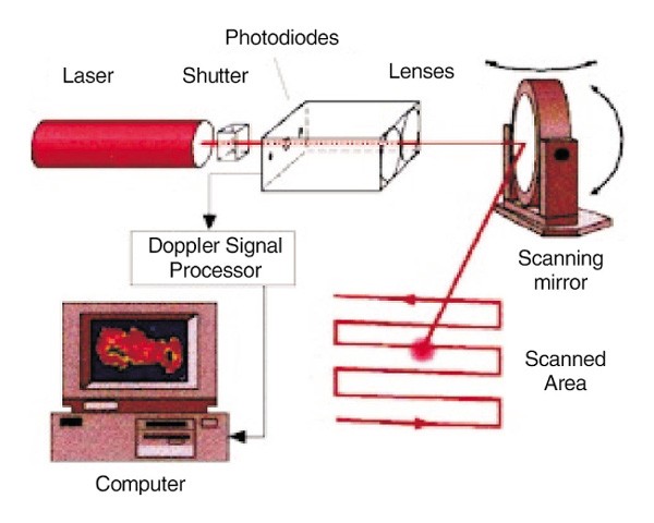 Scanning laser Doppler is a useful technique to assess foot cutaneous ...