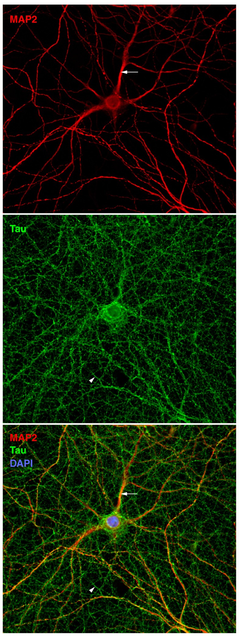 The MAP2/Tau family of microtubule-associated proteins | Genome Biology ...