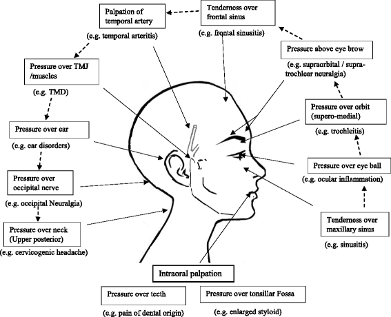 Side-locked headaches: an algorithm-based approach | SpringerLink