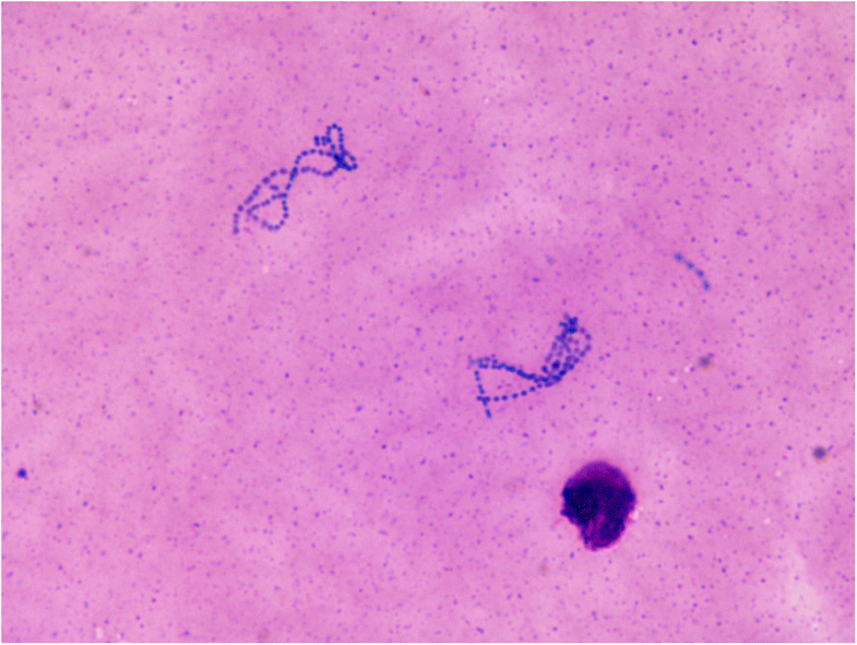 Clinical presentations, management outcomes, and diagnostic dilemma in ...