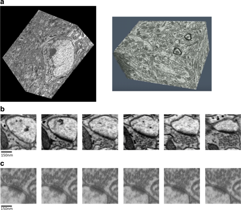 Effective automated pipeline for 3D reconstruction of synapses based on deep learning | BMC ...