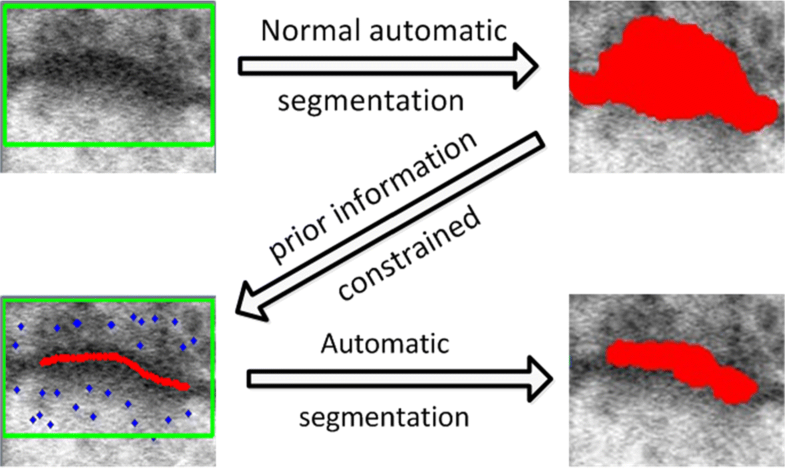 Effective automated pipeline for 3D reconstruction of synapses based on deep learning | BMC ...