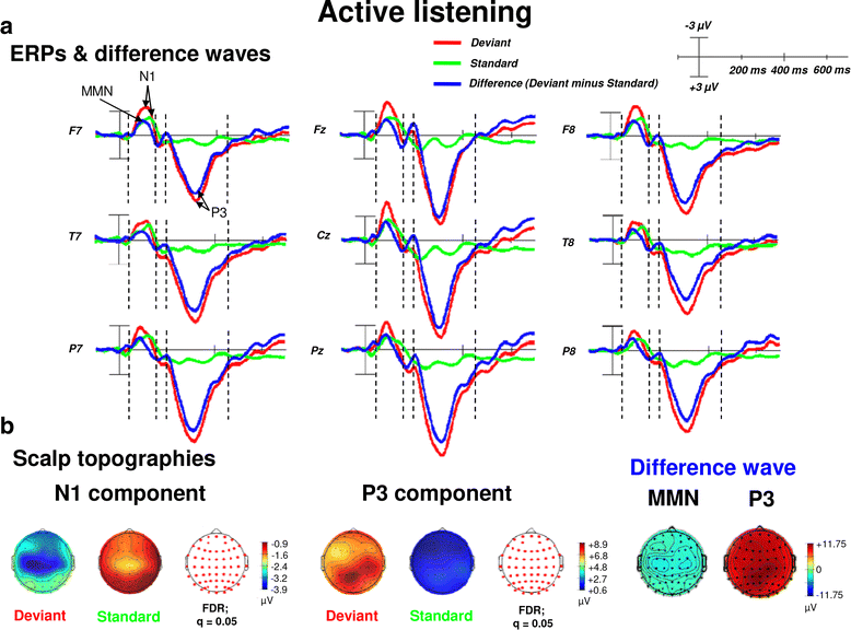 The spatio-temporal dynamics of deviance and target detection in the passive and active auditory ...