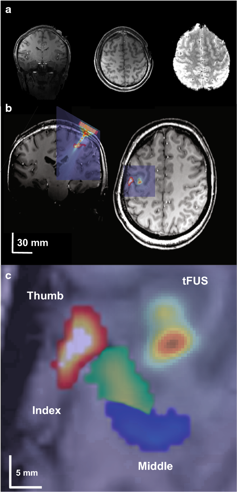 Effects of transcranial focused ultrasound on human primary motor ...