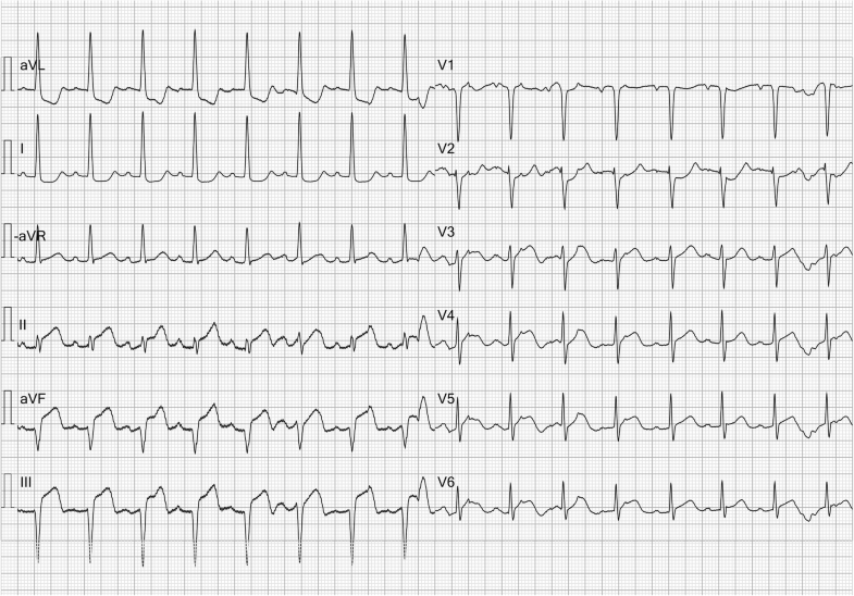 Why complicate an important task? An orderly display of the limb leads ...