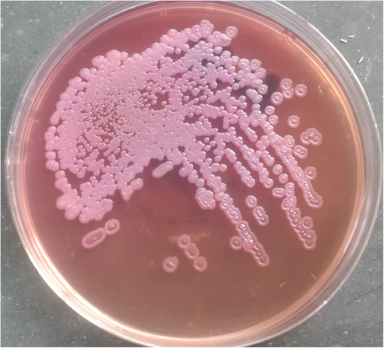 Melioidosis: misdiagnosed in Nepal | BMC Infectious Diseases | Full Text