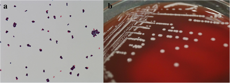Brevibacterium paucivorans bacteremia: case report and review of the ...