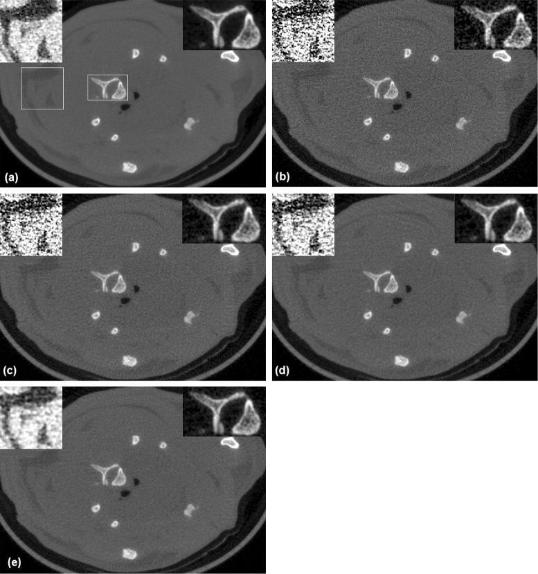 A sinogram denoising algorithm for low-dose computed tomography | BMC Medical Imaging | Full Text