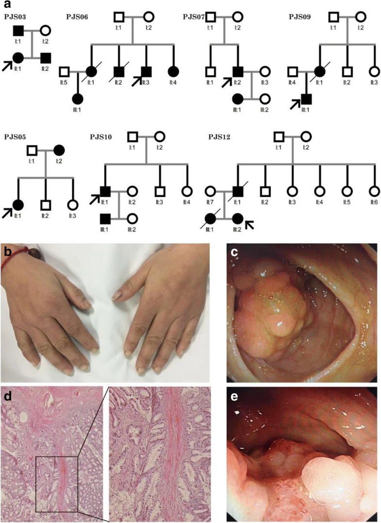 The altered activity of P53 signaling pathway by STK11 gene mutations ...