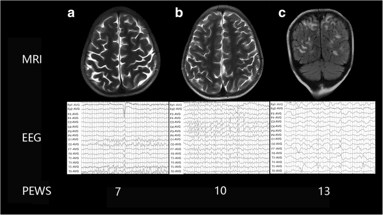 Establishment and utility assessment of posterior reversible ...