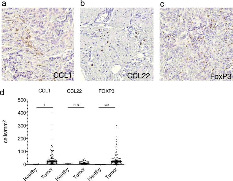 CCL1 is a major regulatory T cell attracting factor in human breast ...