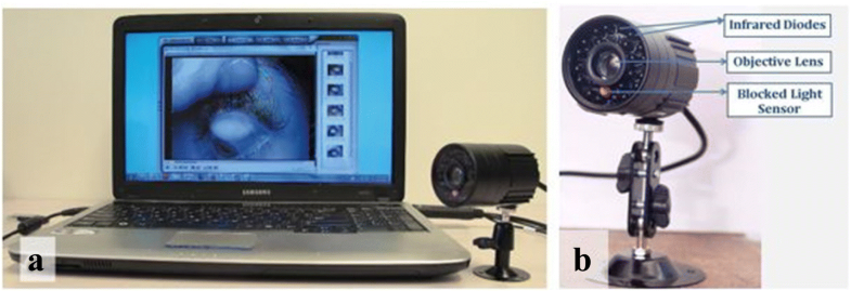 Assessment of meibomian glands using a custom–made meibographer in dry ...