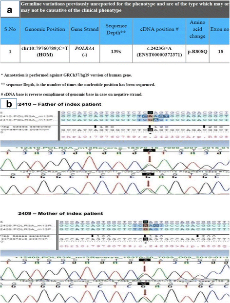 A novel homozygous mutation in POLR3A gene causing 4H syndrome: a case report | BMC Pediatrics ...