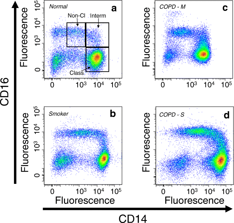 Activation and polarization of circulating monocytes in severe chronic ...