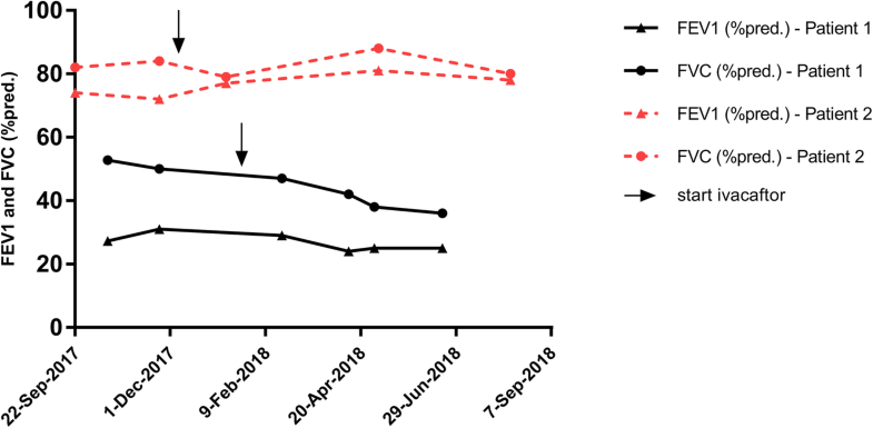 Use of ivacaftor in late diagnosed cystic fibrosis monozygotic twins ...