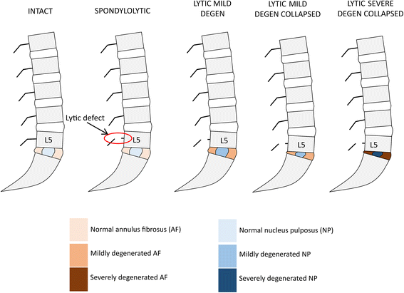 Mild (not severe) disc degeneration is implicated in the progression of ...