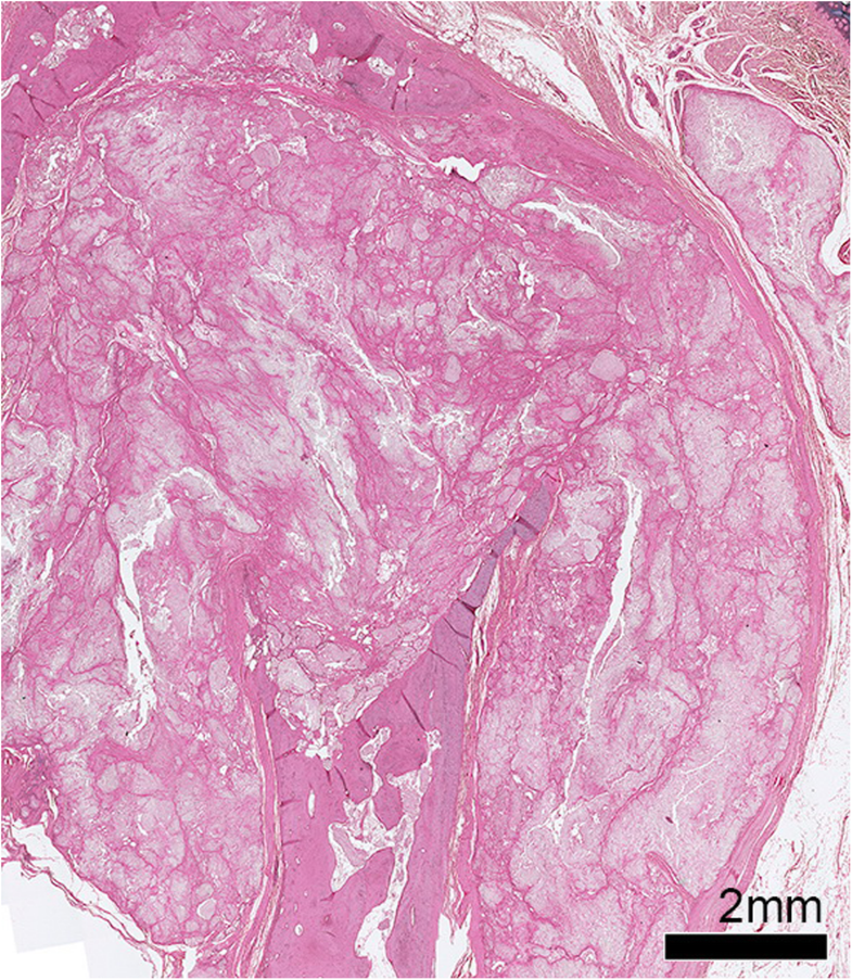 The anatomical pathology of gout: a systematic literature review | BMC ...