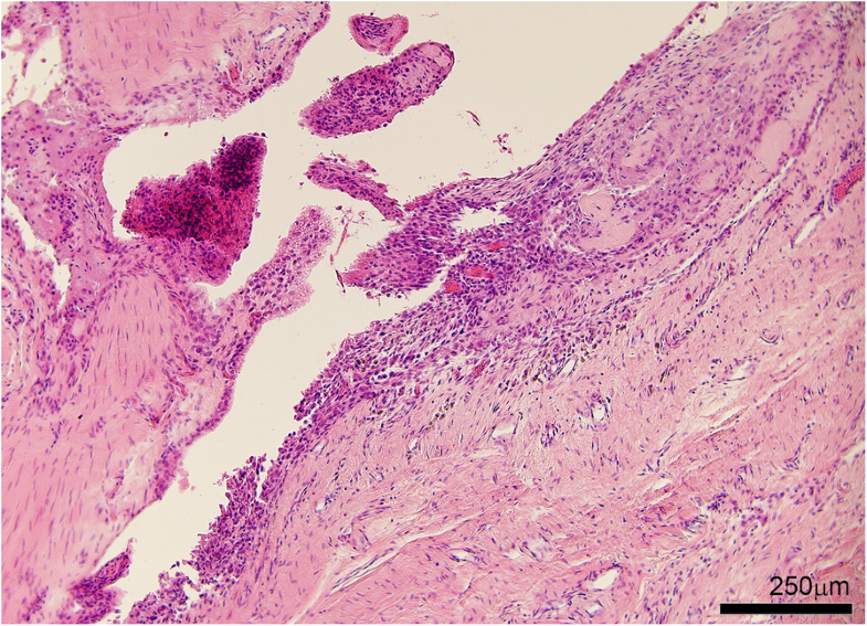 The anatomical pathology of gout: a systematic literature review | BMC ...