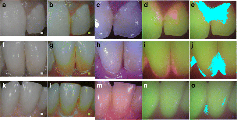Clinical validation and assessment of a modular fluorescent imaging ...