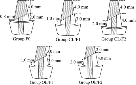 An in vitro study evaluating the effect of ferrule design on the ...