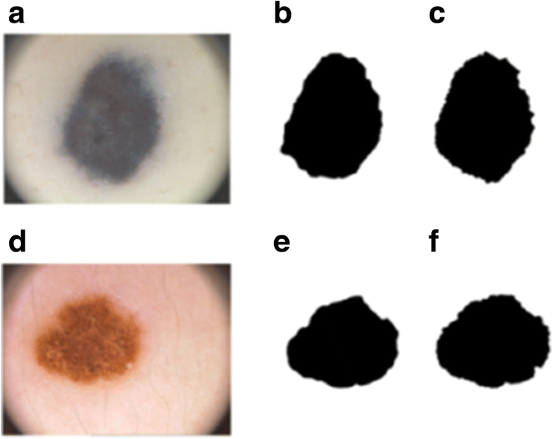 Quantitative evaluation of binary digital region asymmetry with ...