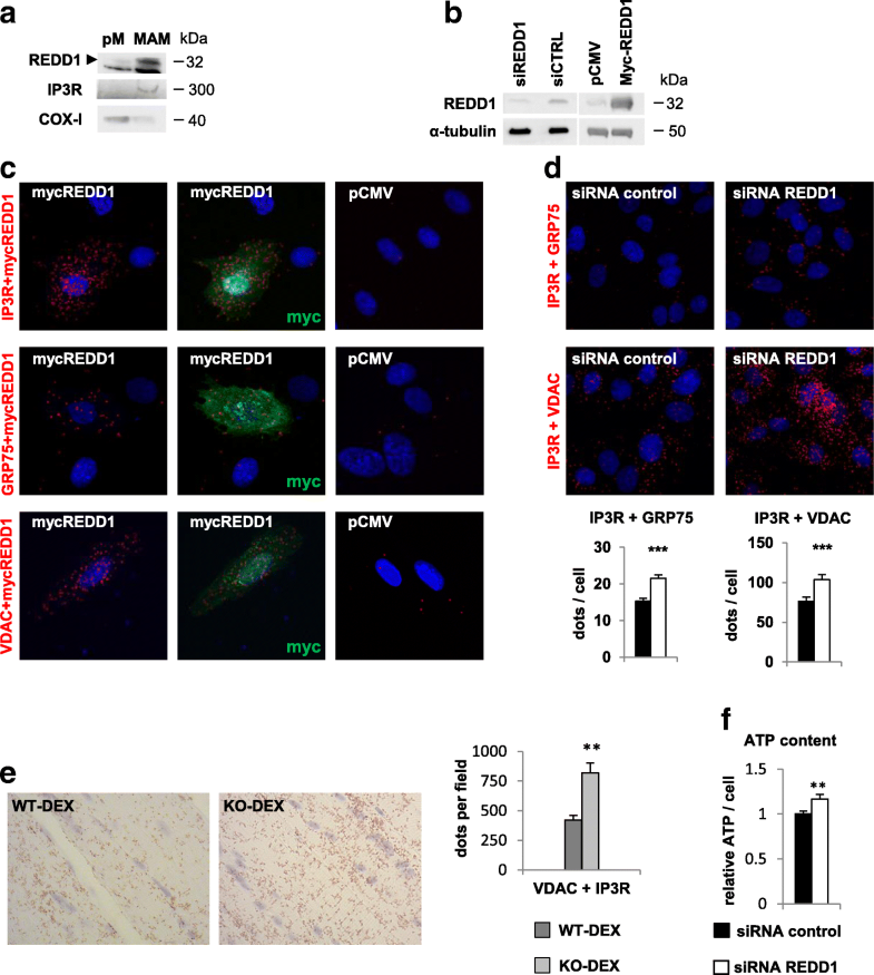 Glucocorticoid-dependent REDD1 expression reduces muscle metabolism to ...