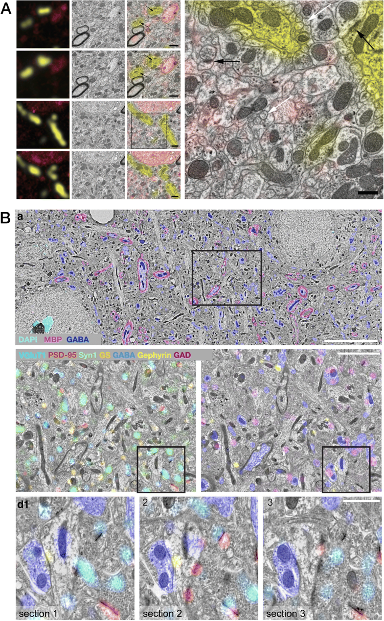Q&A: Array tomography | BMC Biology | Full Text